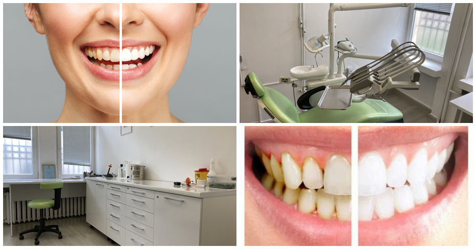 Почистване на зъбен камък полиране и избелване на зъби разграбена оферта 17 06 2023 Grabo